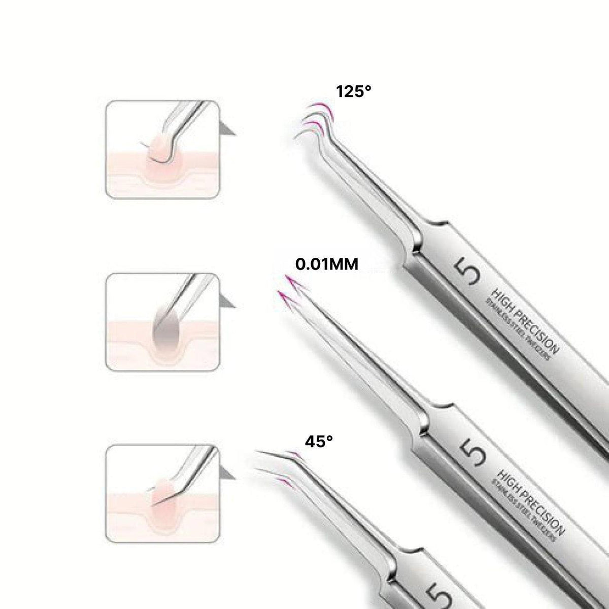Blackhead Pliers - Anti Blackhead Kit – Belro